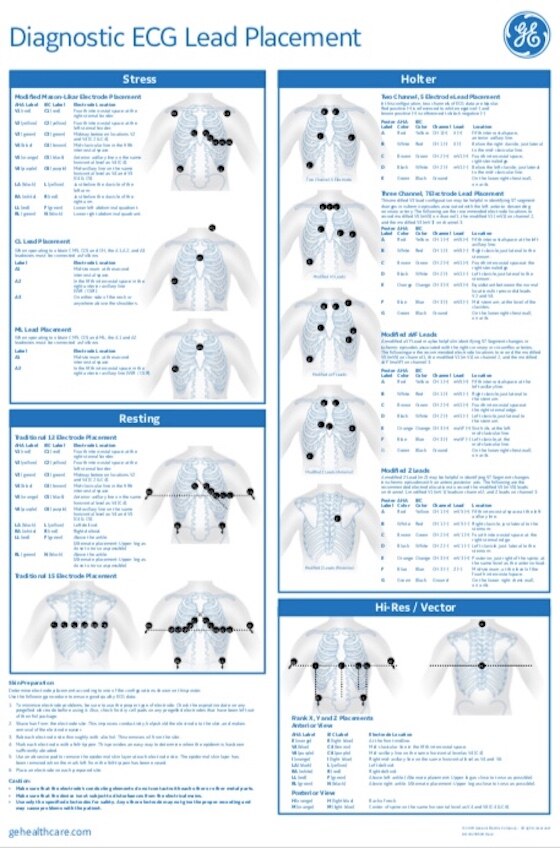 Diagnostic ECG | GE Healthcare