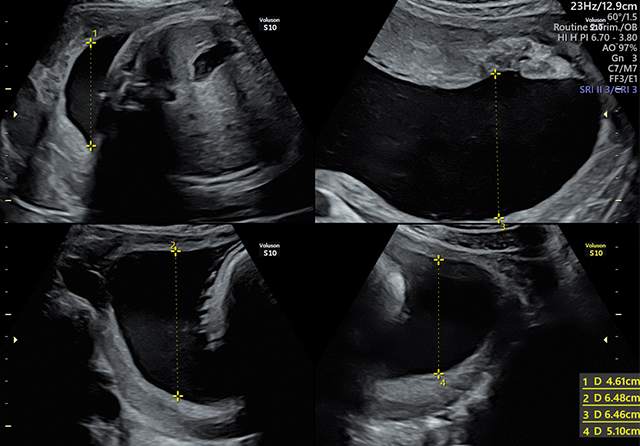 Women’s Health | GE Healthcare