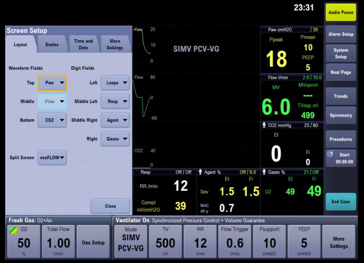 Aisys CS² | GE Healthcare