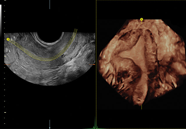 Women’s Health | GE Healthcare