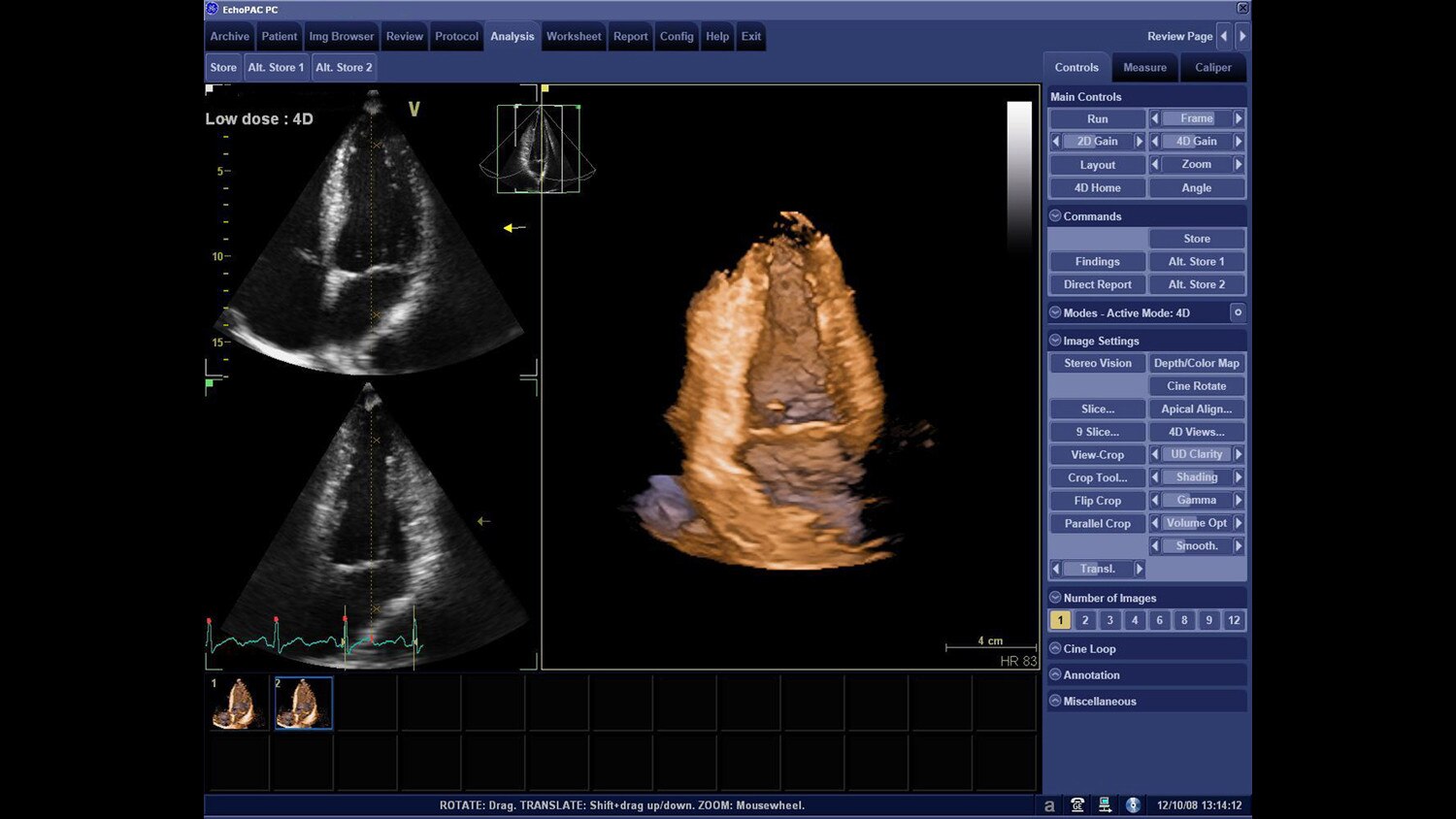 EchoPAC Clinical Workstation Software | GE Healthcare