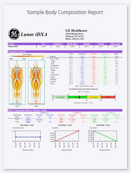 Composer Reporting | GE Healthcare (Australia & New Zealand)