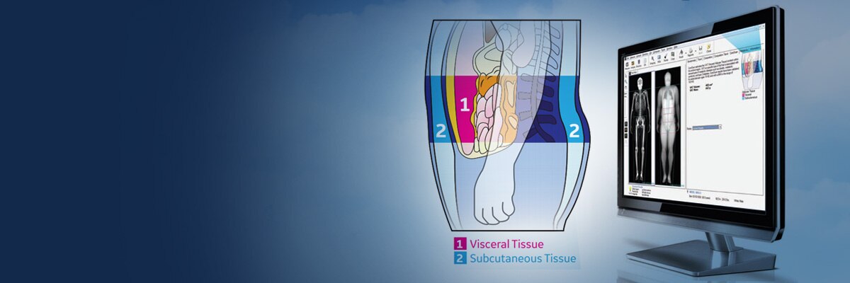 CoreScan | GE Healthcare (Australia & New Zealand)