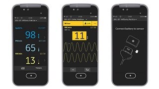 Portrait™ Mobile | GE HealthCare (Australia & New Zealand)