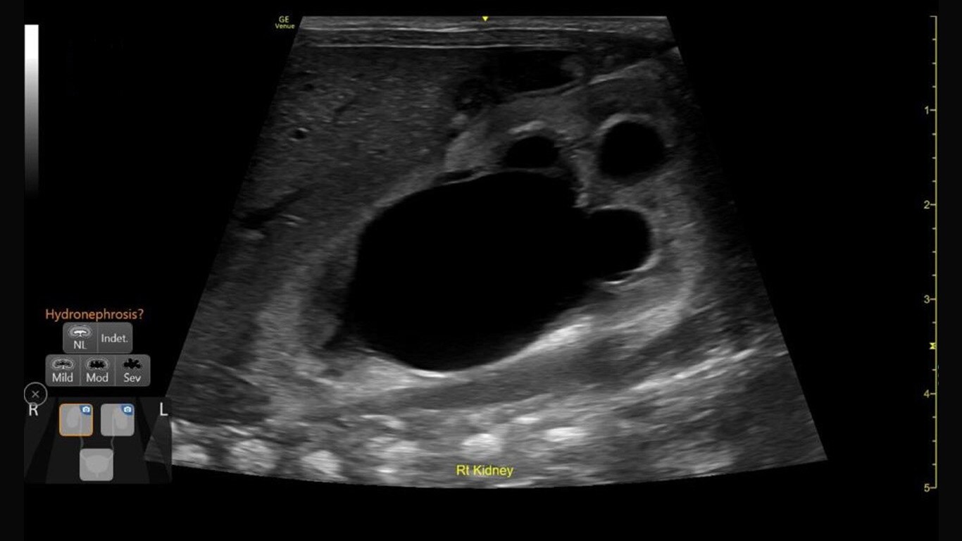 Venue Point of Care Ultrasound for Emergency Care | GE HealthCare ...