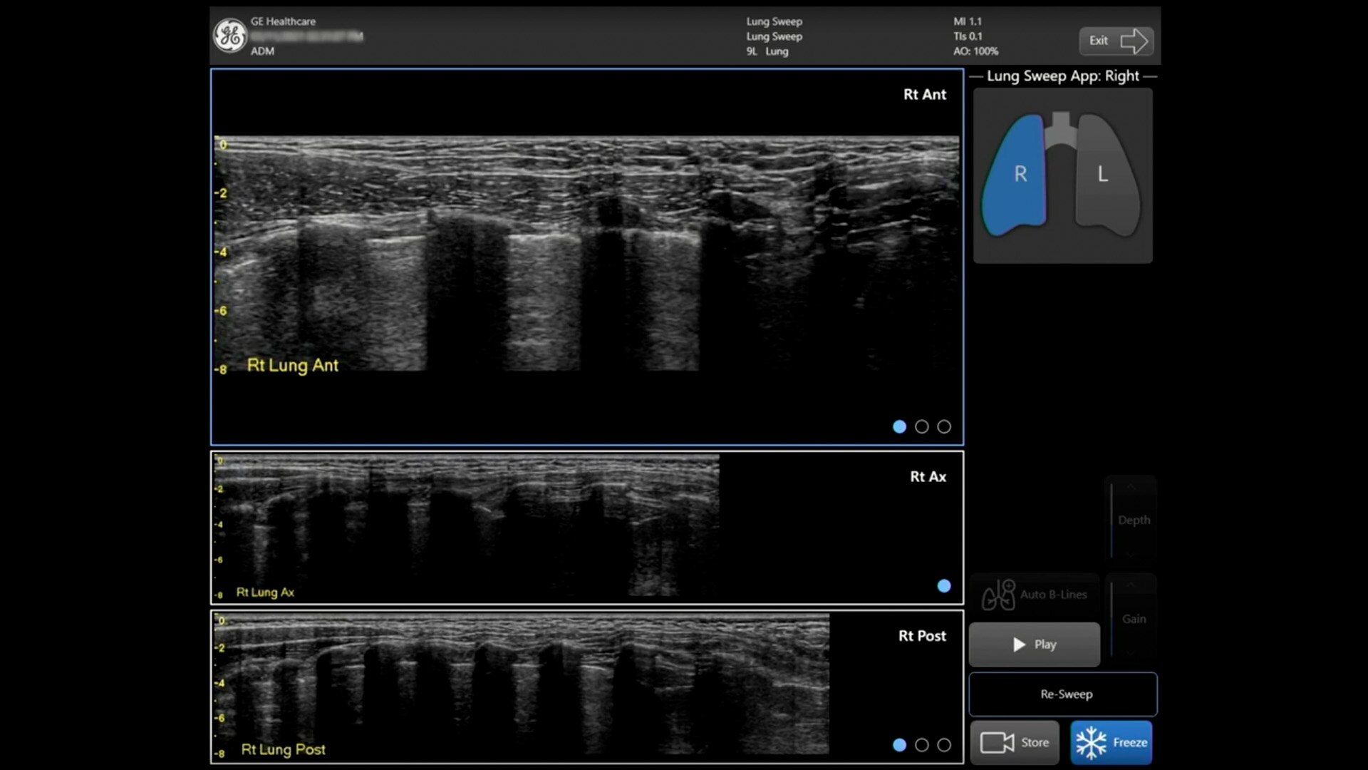 Point of Care Contact Us | GE HealthCare (Australia & New Zealand)