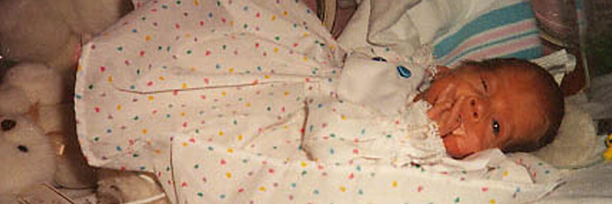 A Maternal Infant Care story by Dianne Maroney | GE HealthCare ...