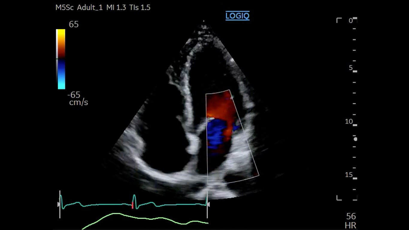 LOGIQ E10 Clinical Images | GE HealthCare (Australia & New Zealand)