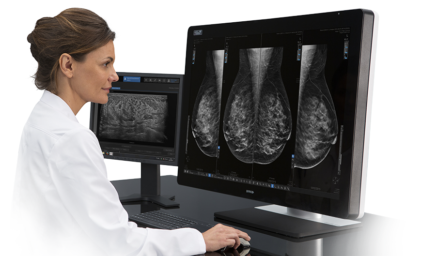Seno Iris | GE HealthCare (Australia & New Zealand)