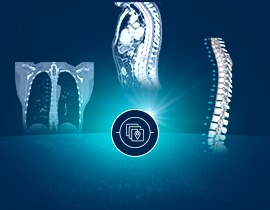 Bone Vcar Advanced Visualization for Computed Tomography | GE ...