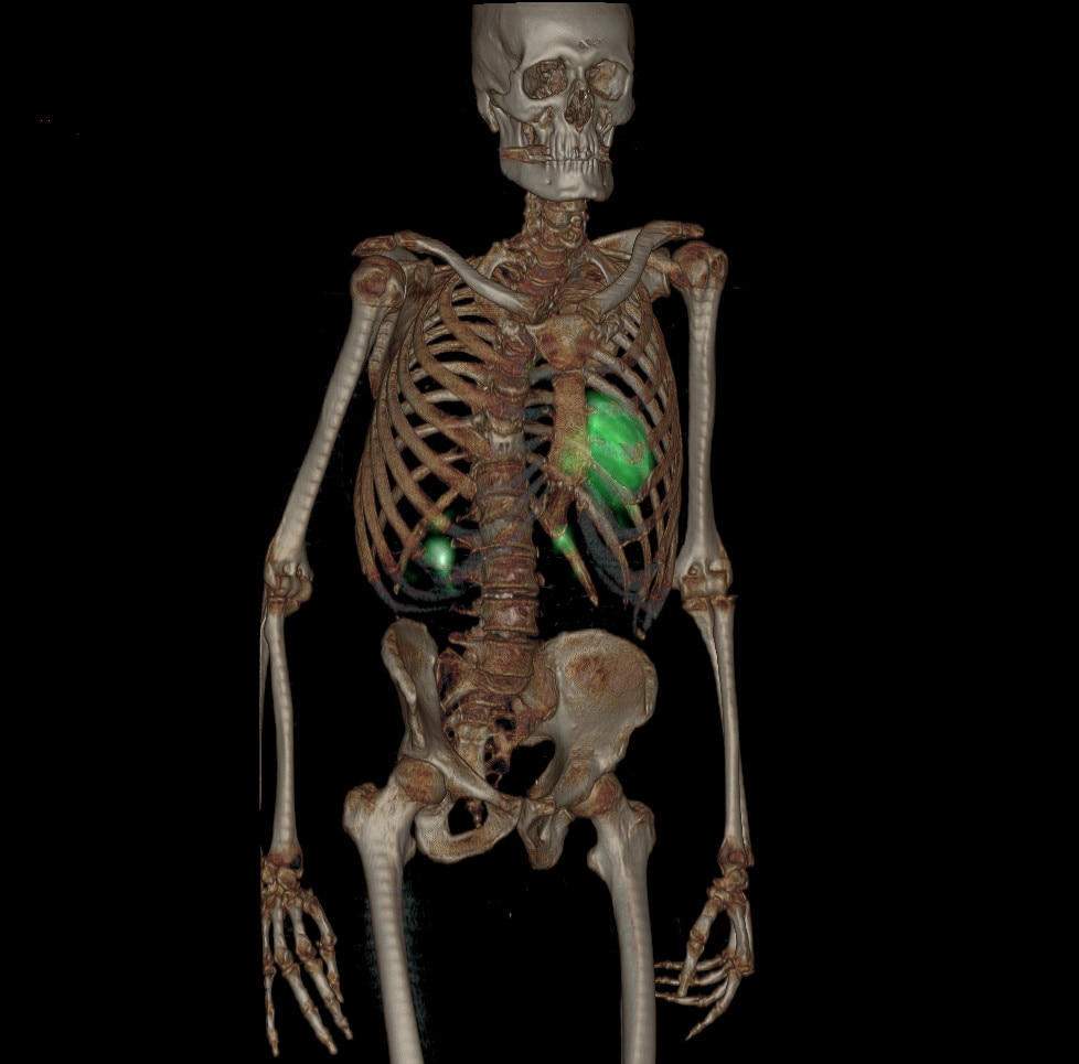 Volume Viewer | GE HealthCare (Australia & New Zealand)