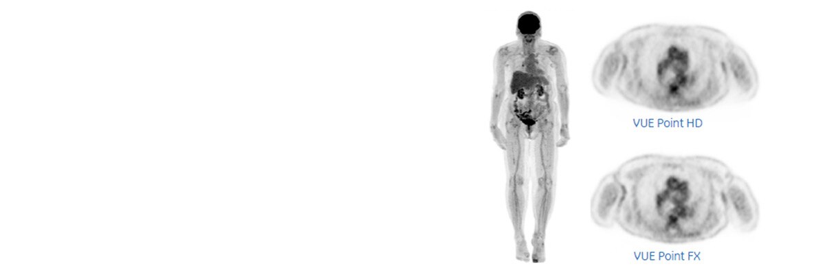 VUE Point FX | GE HealthCare (Australia & New Zealand)